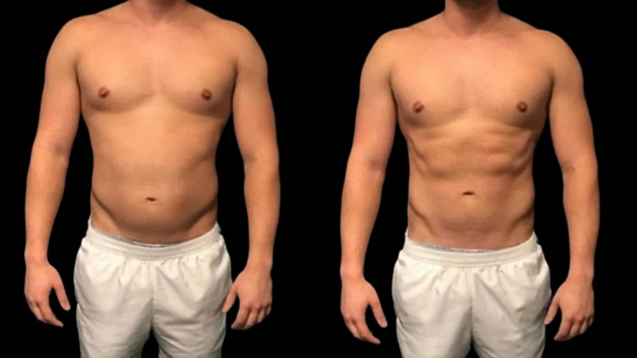Recovery Tips for Male Body Sculpting Surgery - All for Bloggers: Your ...
